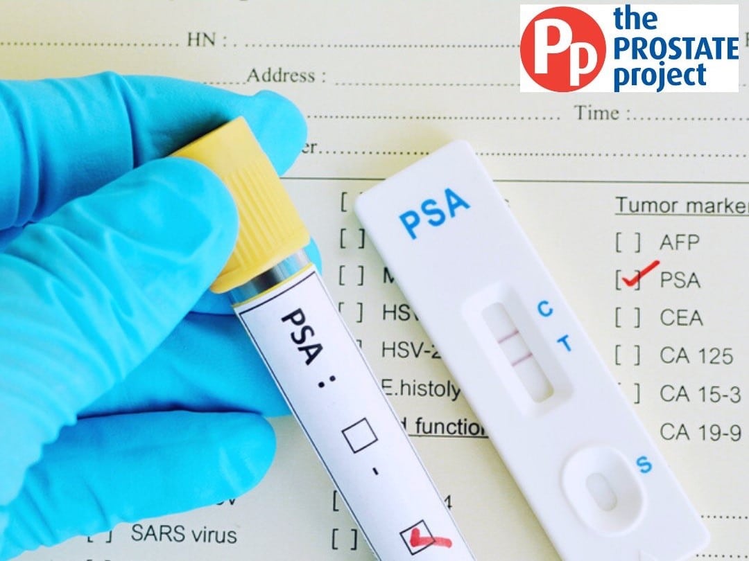 Prostate Cancer Screening Programme - A Must Read for All Men | Surrey ...
